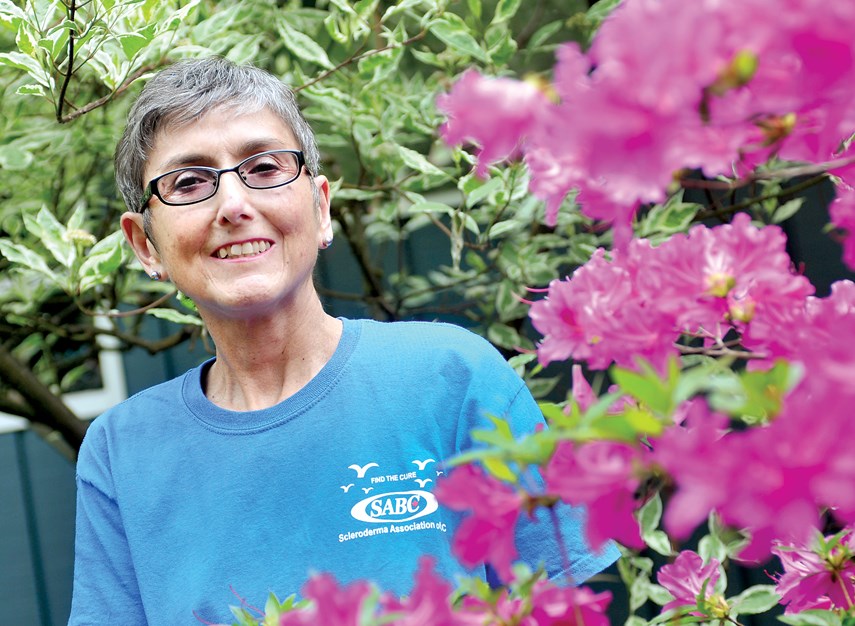 Scleroderma Association Of B C Hosts Month Long Campaign For Rare Disease Research The Daily Scan