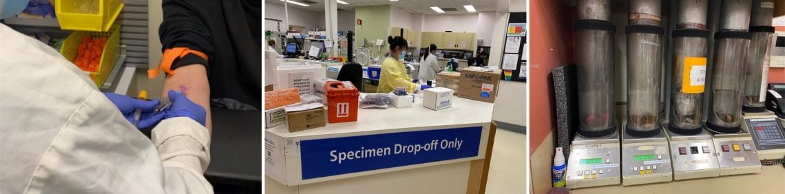 The journey of a blood sample - The Daily Scan