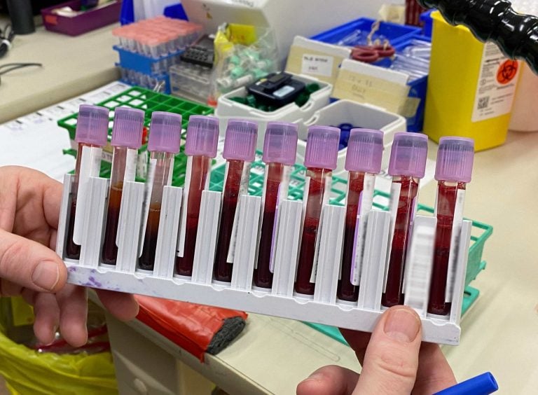 The journey of a blood sample - The Daily Scan