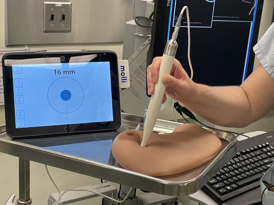 Going wireless: new approach makes breast surgeries easier on patients ...