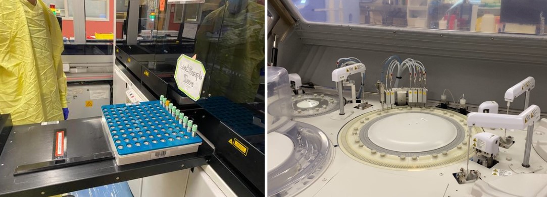 Behind the scenes at the hospital laboratory - The Daily Scan